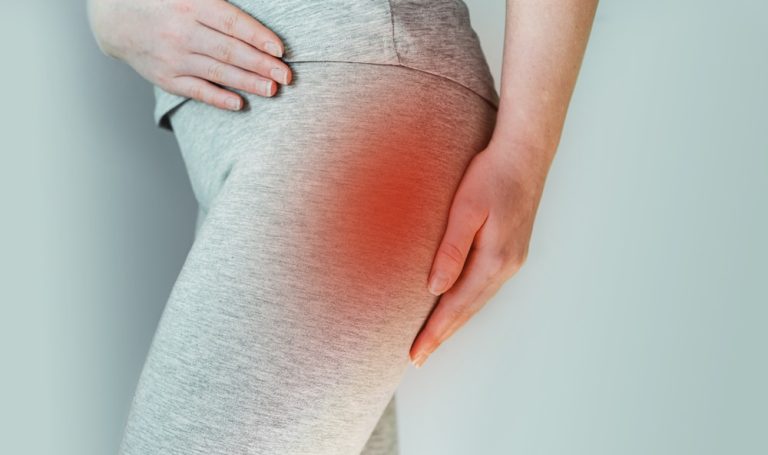 How to Sleep With Piriformis Syndrome | Back in Motion